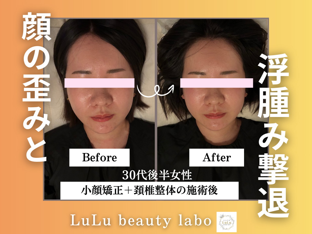 小顔を作る歩き方!毎日変わるフェイスラインの整え方(2026年06月07日 11時00分) 小顔矯正/美容整体 LuLu beauty ...